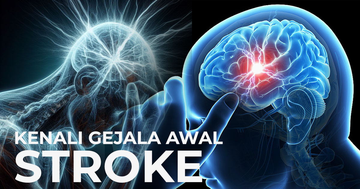Mengenal Gejala Awal Stroke dan Cara Pencegahannya | Surau.co